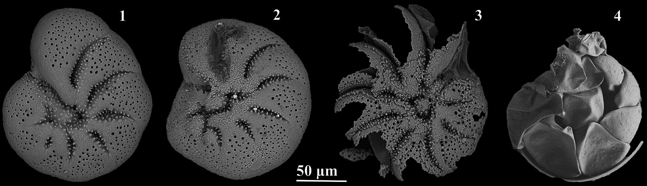 Benthic Foraminifera | Laidlaw Scholars Network